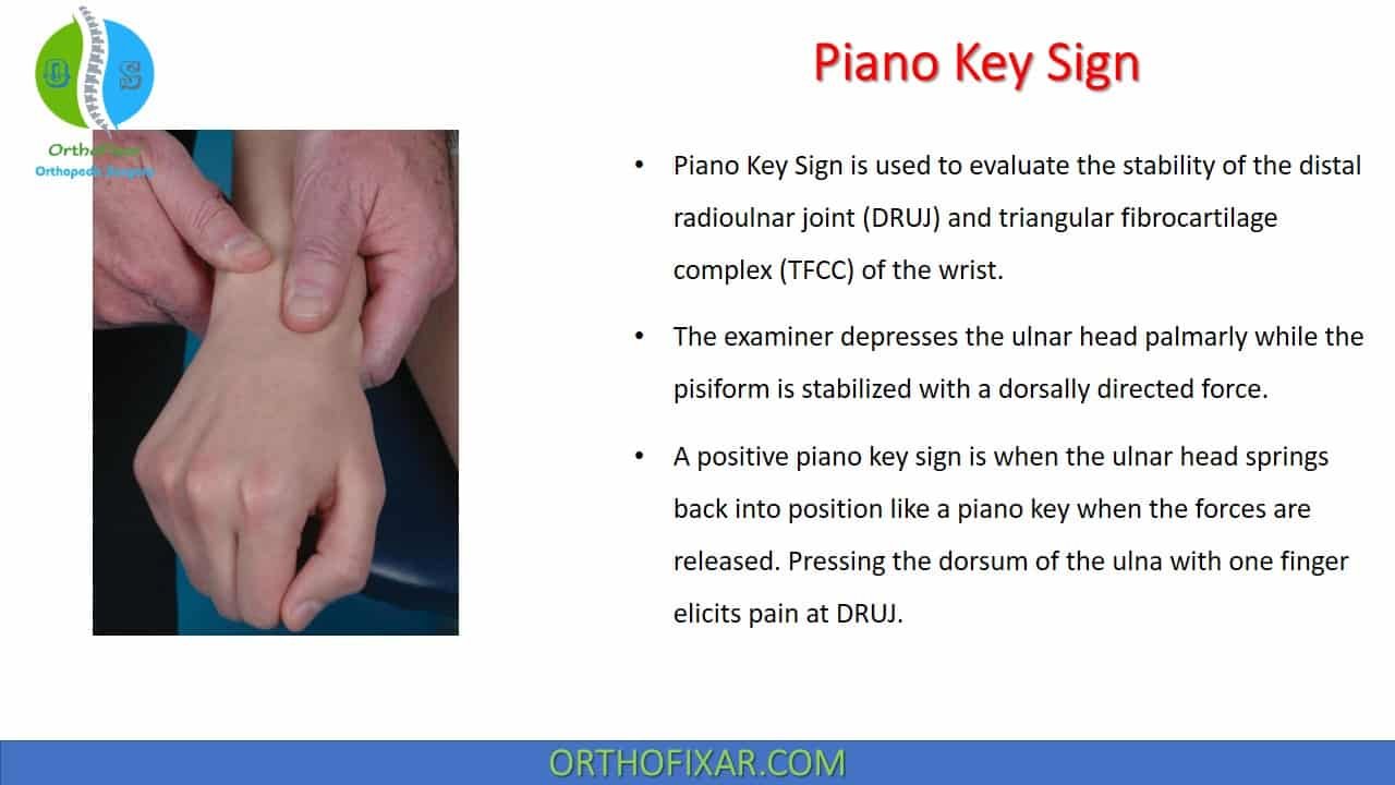 What Is Piano Key Sign | INS.